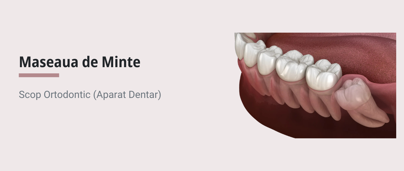 Extractie Masea de Minte in Scop Ortodontic (Aparat Dentar) | MSmile ...